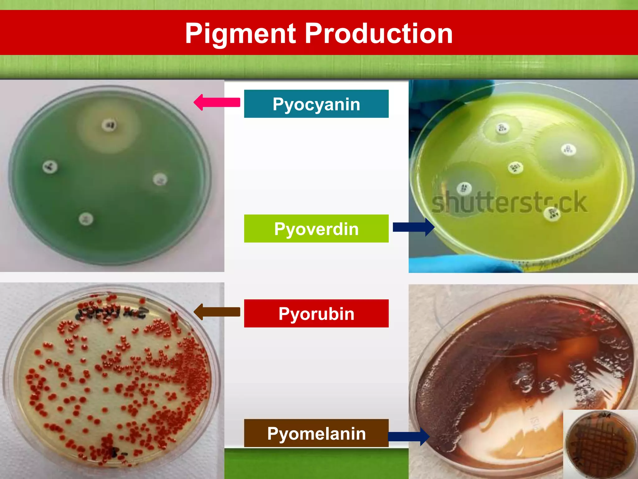 GNNF (Pseudomonas and Acinetobacter).ppt