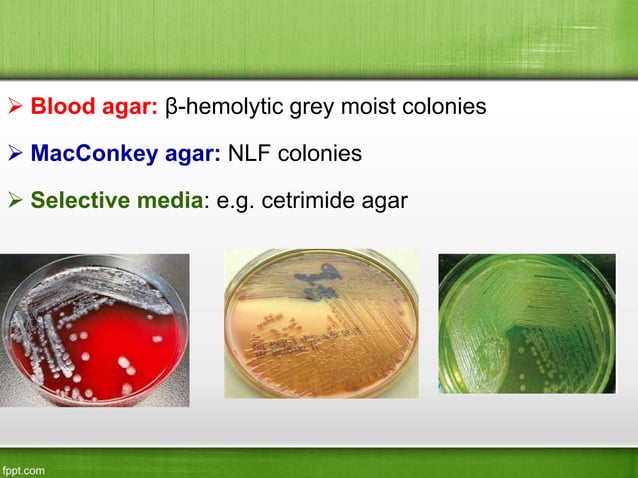 GNNF (Pseudomonas and Acinetobacter).ppt | Infectious Diseases ...