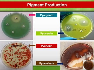 GNNF (Pseudomonas and Acinetobacter).ppt
