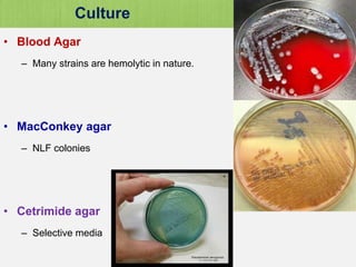Acinetobacter On Macconkey Agar