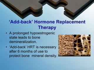 GnRH Analogues in Heavy Menstrual Bleeding | PPTX