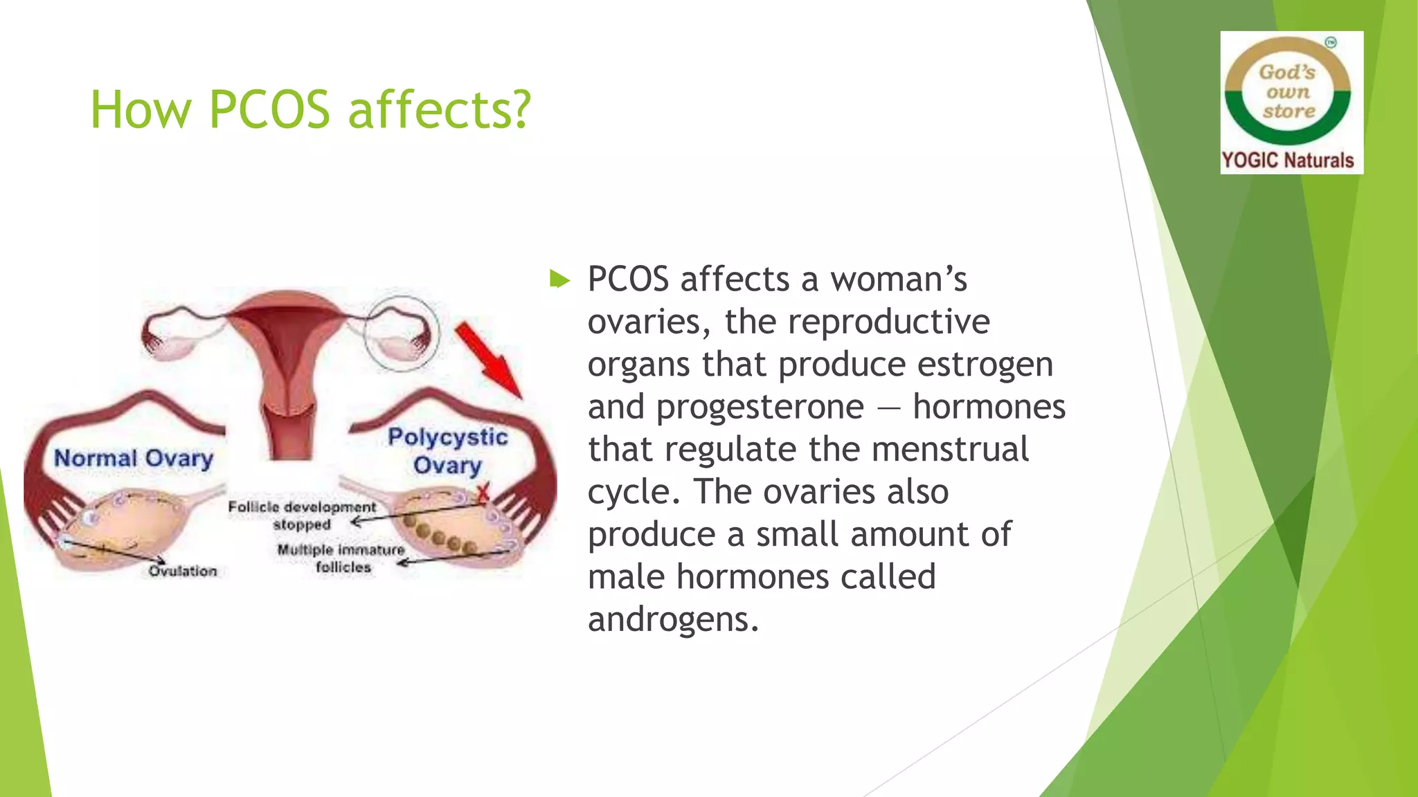 Polycystic Ovary Syndrome PCOS | PPTX
