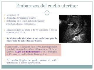 Embarazo Ectópico | PPT