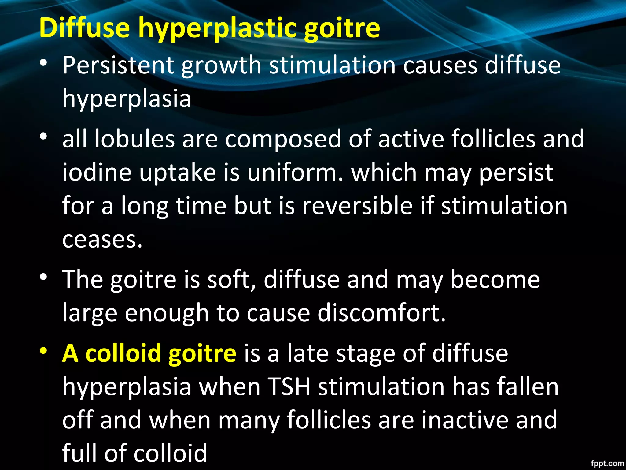 Goiter | PPT