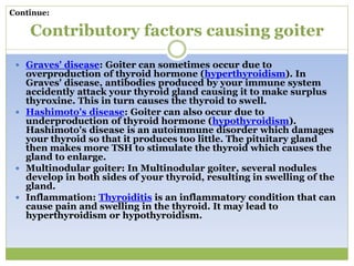 Goiter | PPTX