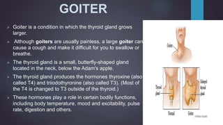 Goiter and hypothyriodism | PPT