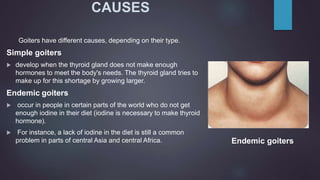 Goiter and hypothyriodism | PPT