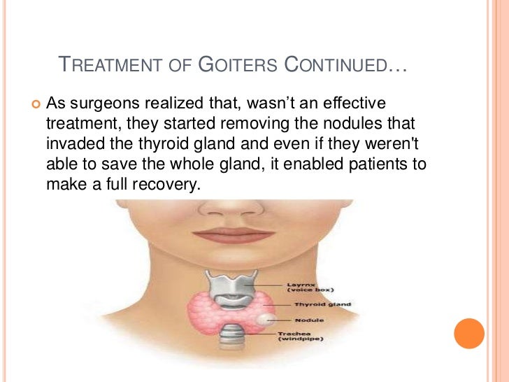 Goiters 120223070355-phpapp01[1]
