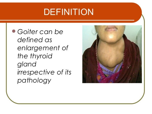 Goitres
