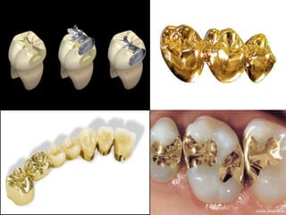 Gold and its alloys | PPT