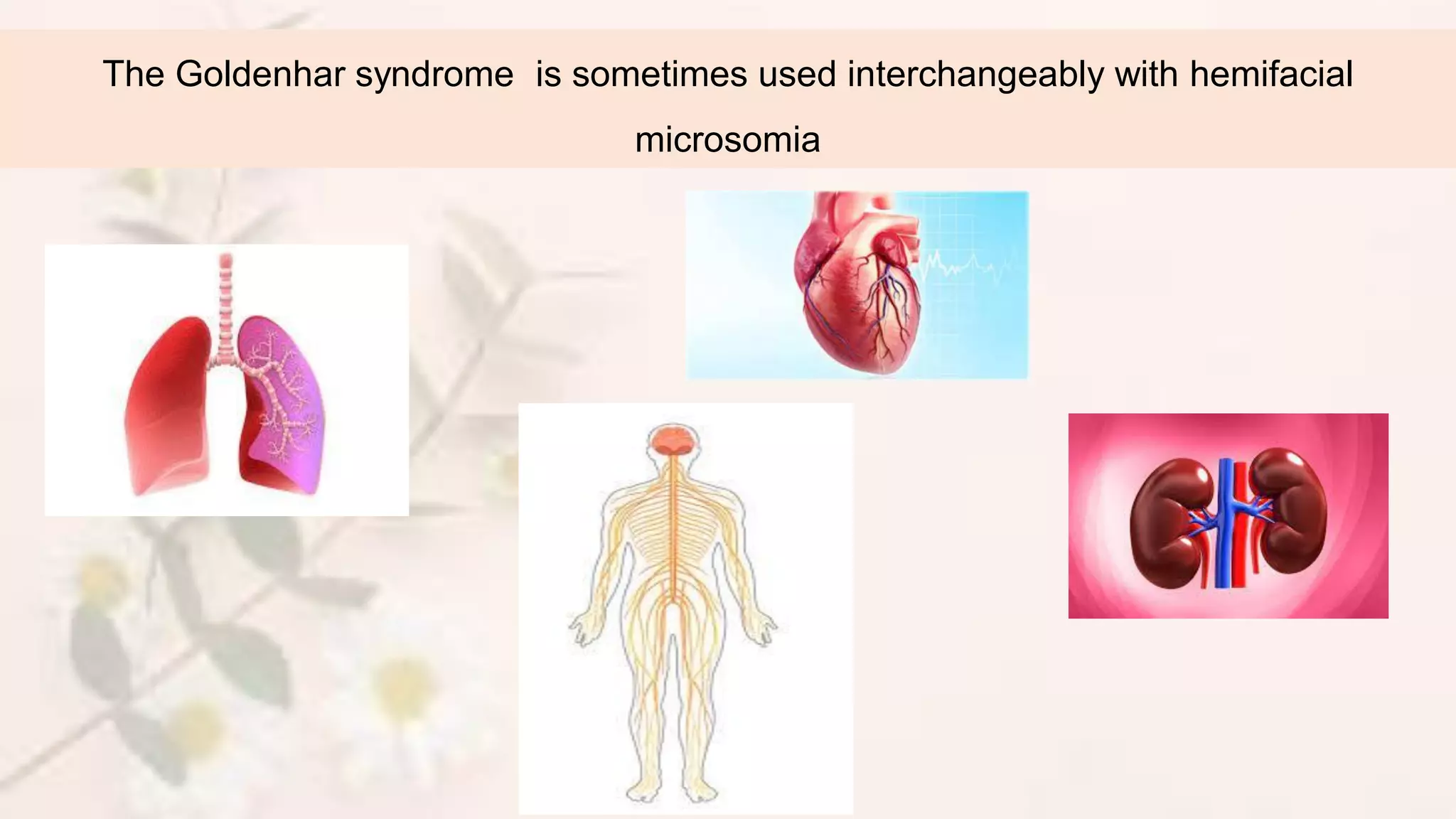 Goldenhar syndrome Ayurveda view and management | PDF