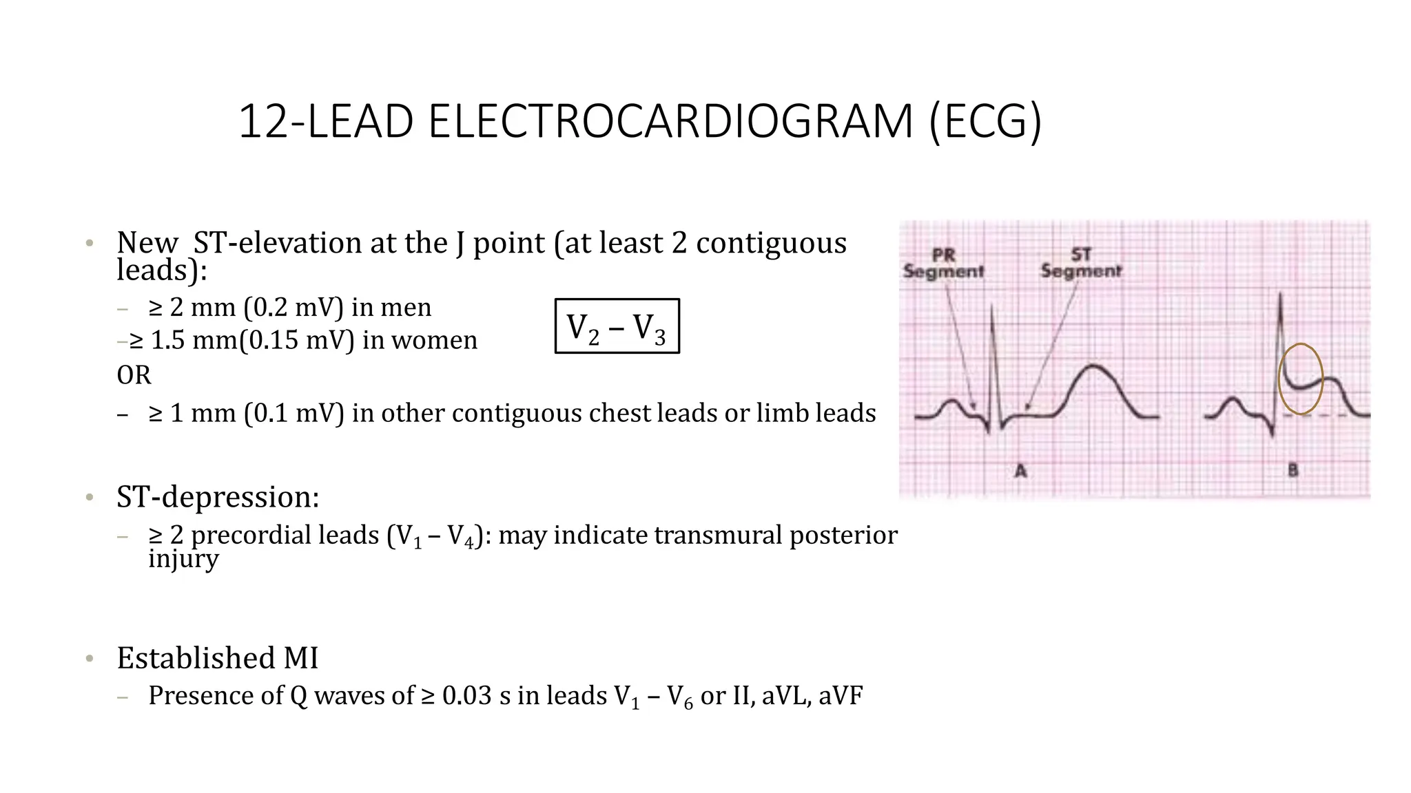 GOLDEN HOUR IN ST Elevation Myocardialinfarction | PPTX