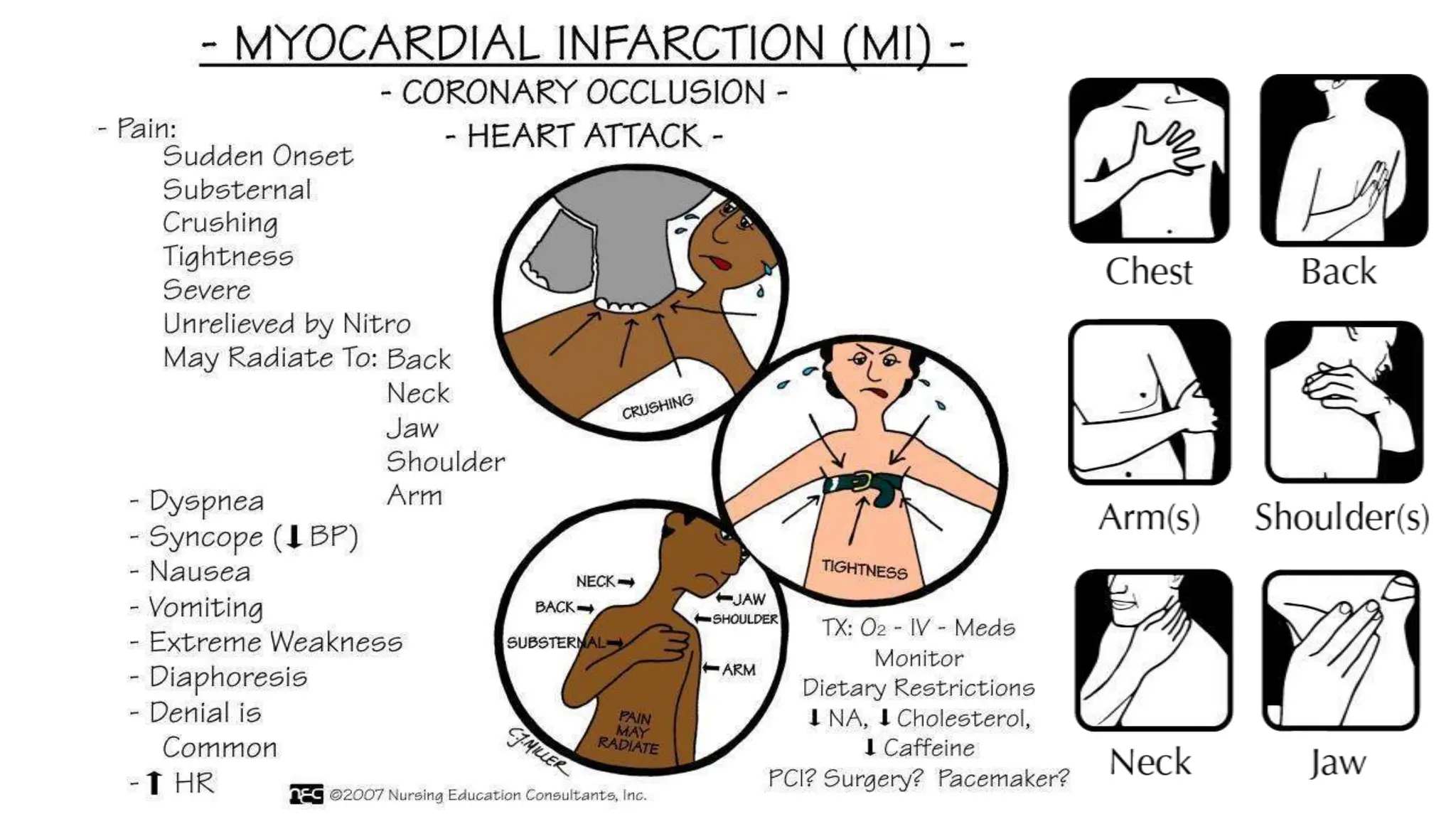 GOLDEN HOUR IN ST Elevation Myocardialinfarction | PPTX