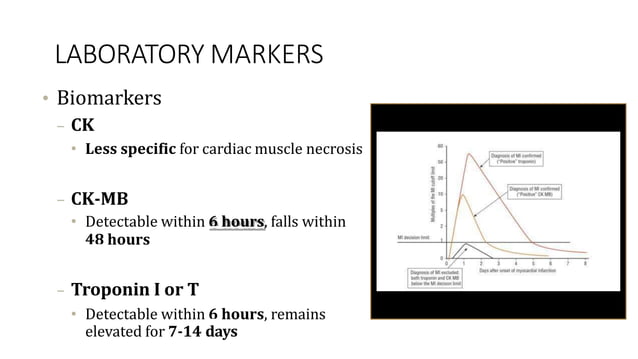 GOLDEN HOUR IN ST Elevation Myocardialinfarction | PPTX | Heart and ...