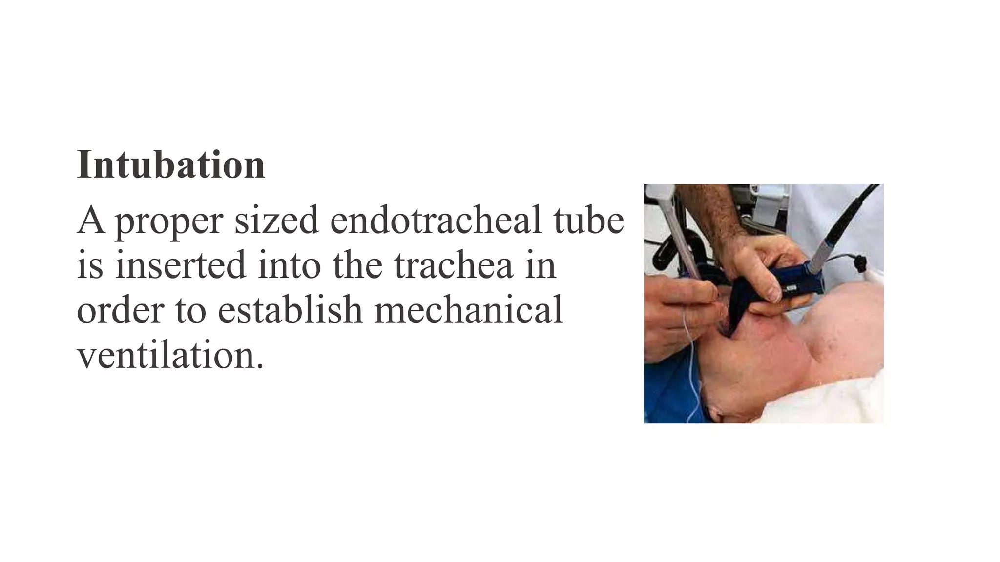 GOLDEN RULES OF ANESTHESIA.pptx