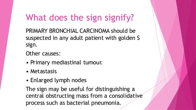 Golden S sign