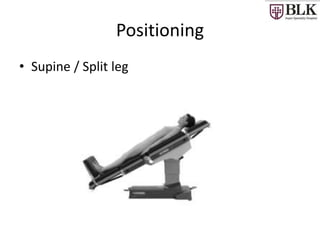 Golden steps to perform laparoscopic sleeve gastrectomy | PPT