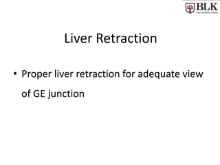 Golden steps to perform laparoscopic sleeve gastrectomy | PPTX