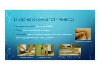 Gonalgia cs | PDF