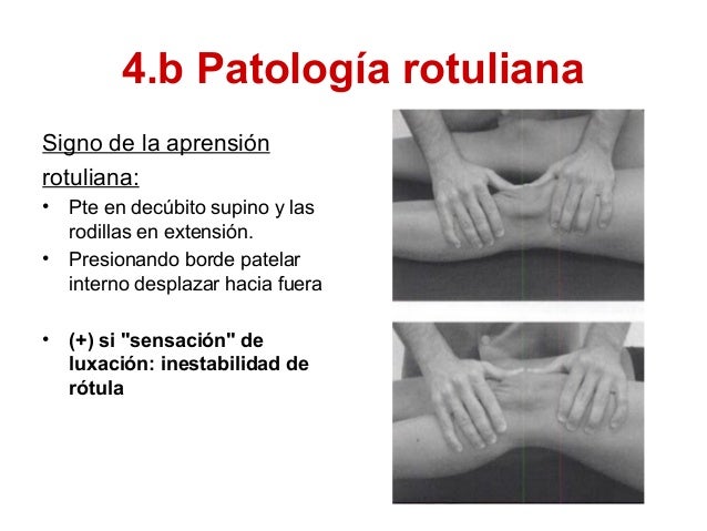 Gonalgia en ap