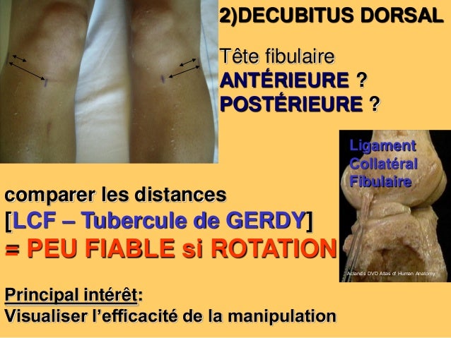 Gonalgie M25.56 G | Gonarthritis – LNJE