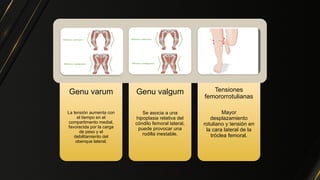 GONARTROSISdw rodilla y desgaste articular | PPTX
