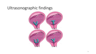 Management of Cervical Incompetence | PPT