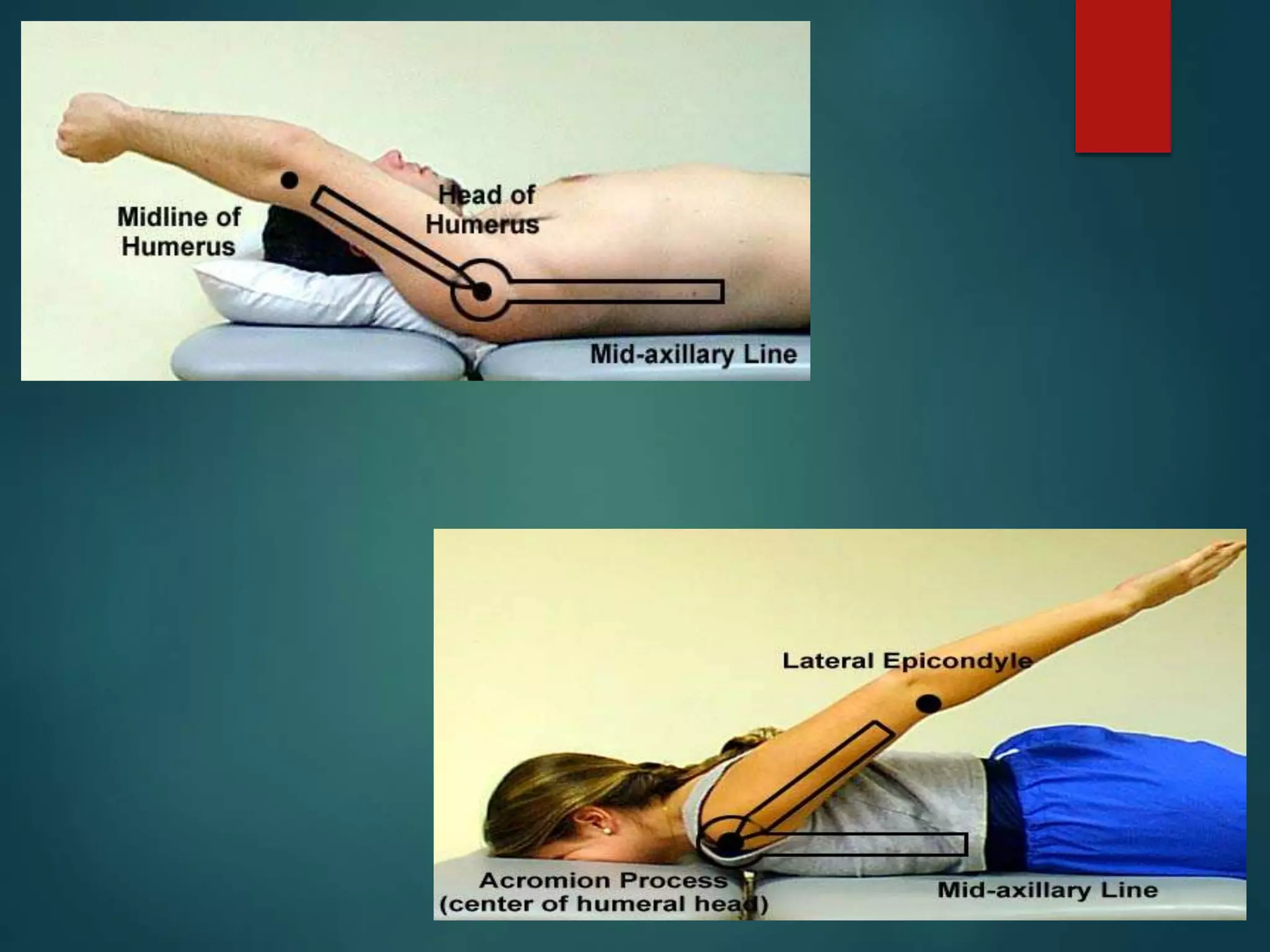Goniometer (range of motion ) | PPTX