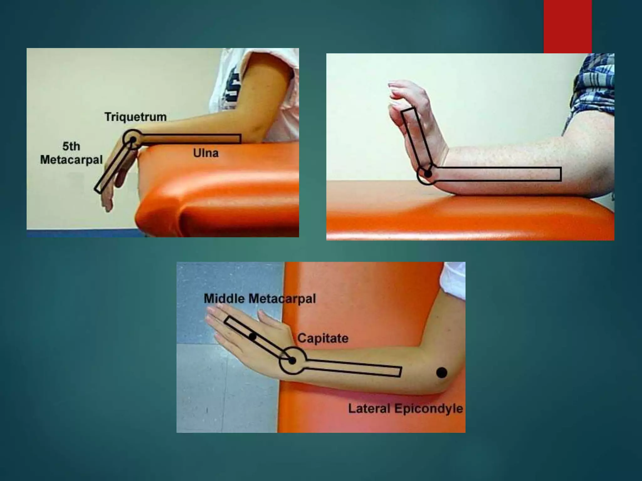 Goniometer (range of motion ) | PPTX