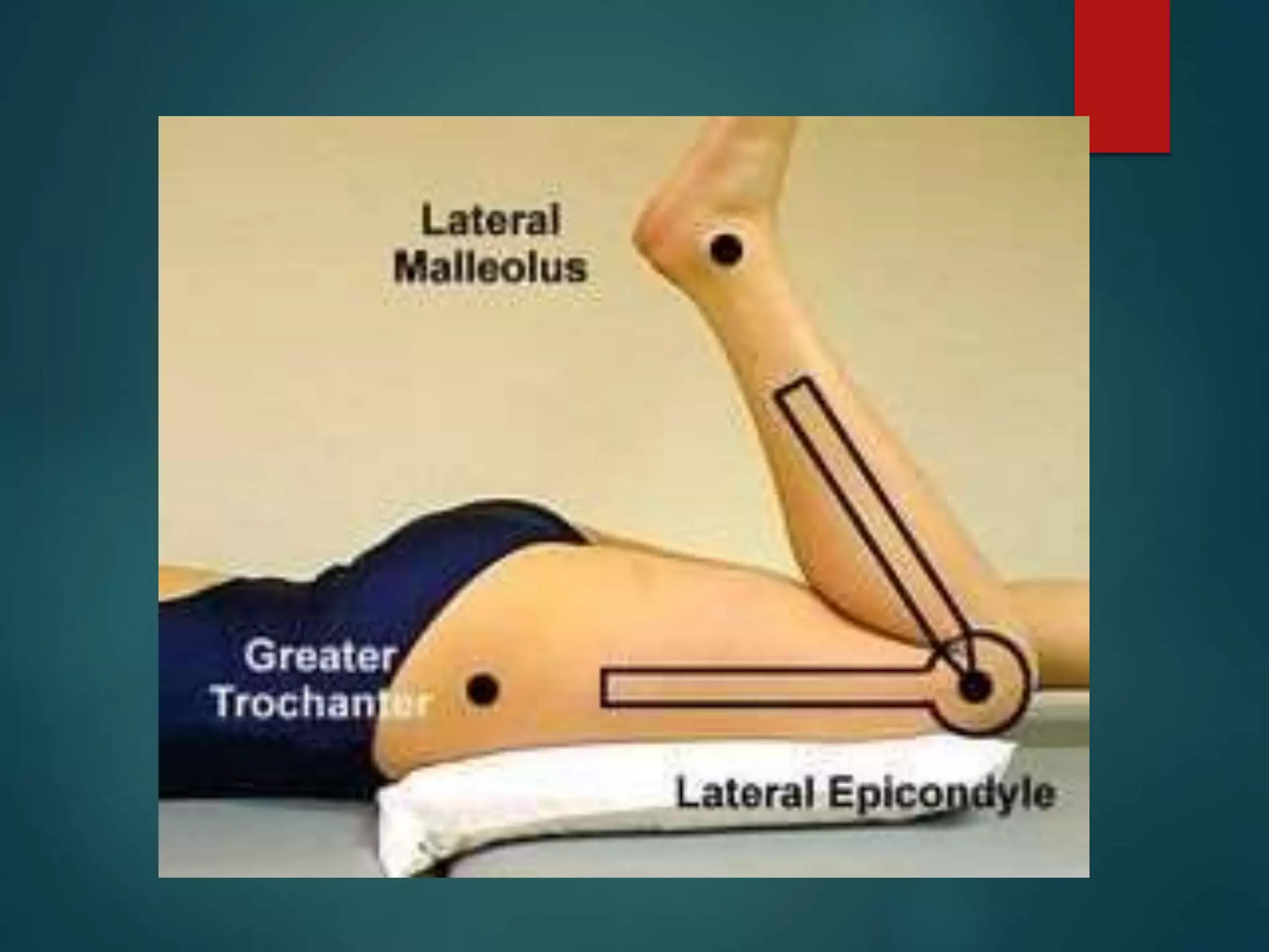 Goniometer (range of motion ) | PPTX