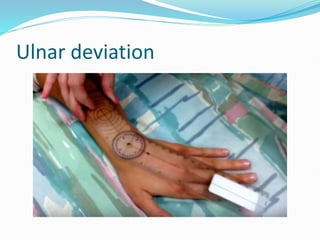 Goniometer prac upper limb.pptx,,,,,,,,, | PPTX