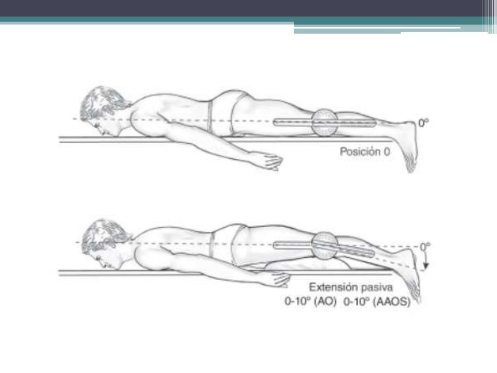 Goniometria de los miembros inferiores