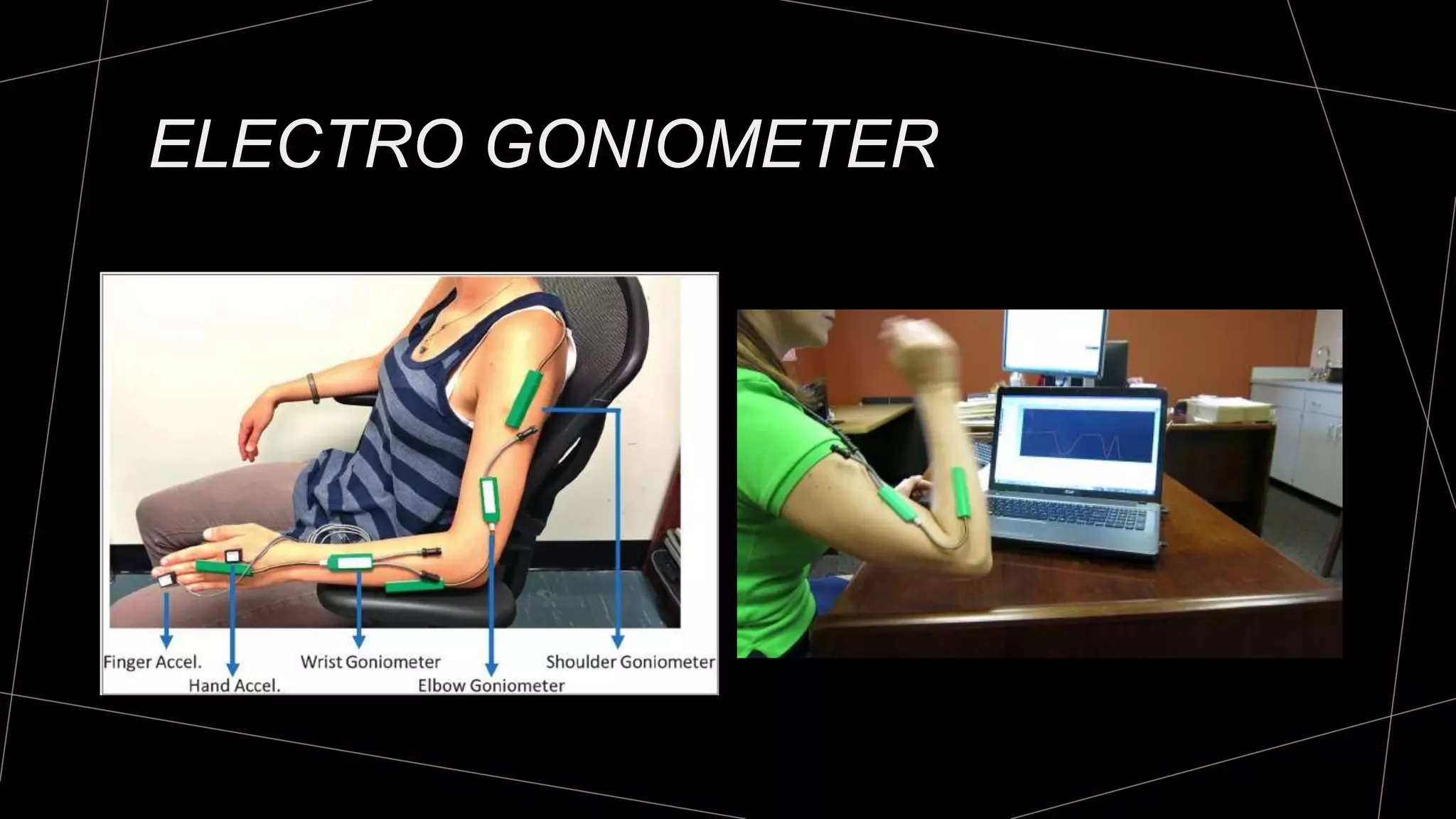 Goniometry for Wrist & Fingers | PPTX