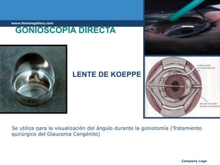 Gonioscopía, historia, tipos, uso conceptos | PPT