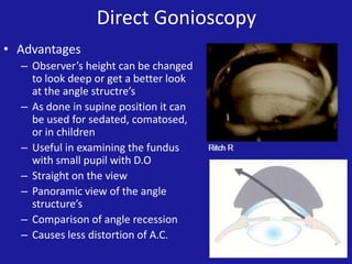 Gonioscopy | PPTX
