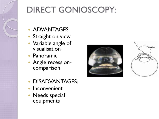 Gonioscopy | PPTX