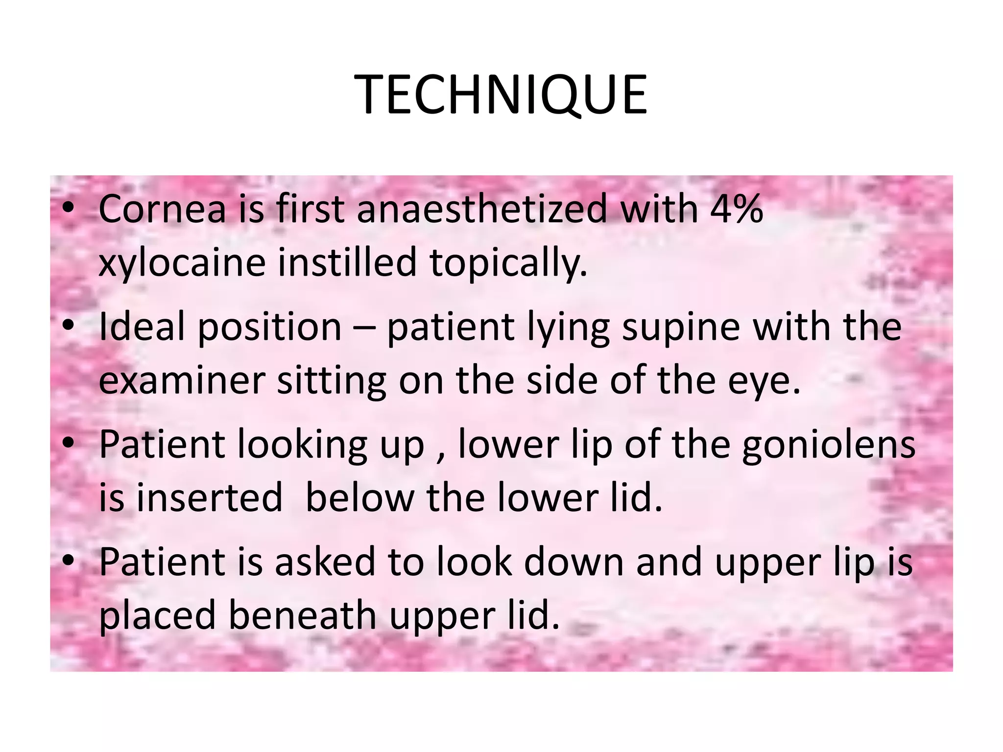 Gonioscopy | PPTX