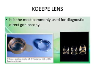 Gonioscopy Lens