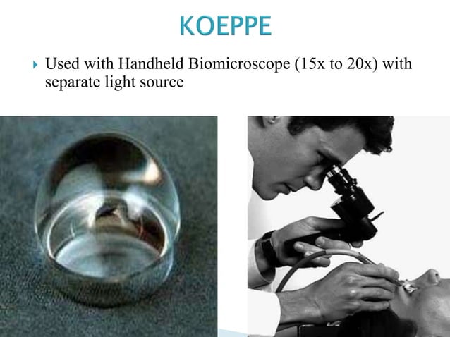 Gonioscopy Ppt