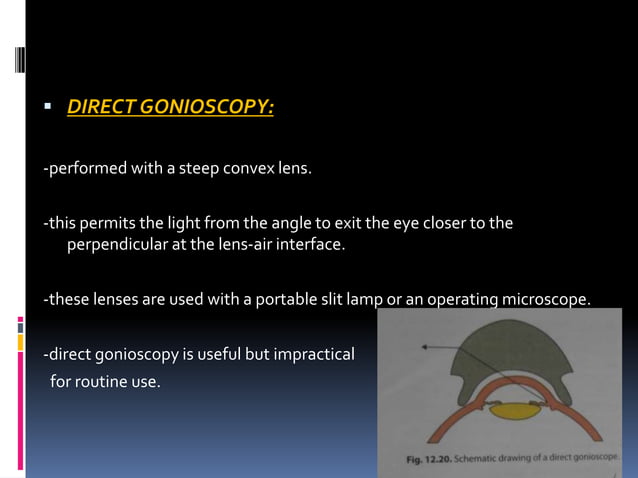 Gonioscopy: gonioscopic lenses, principle and clinical aspects | PPTX