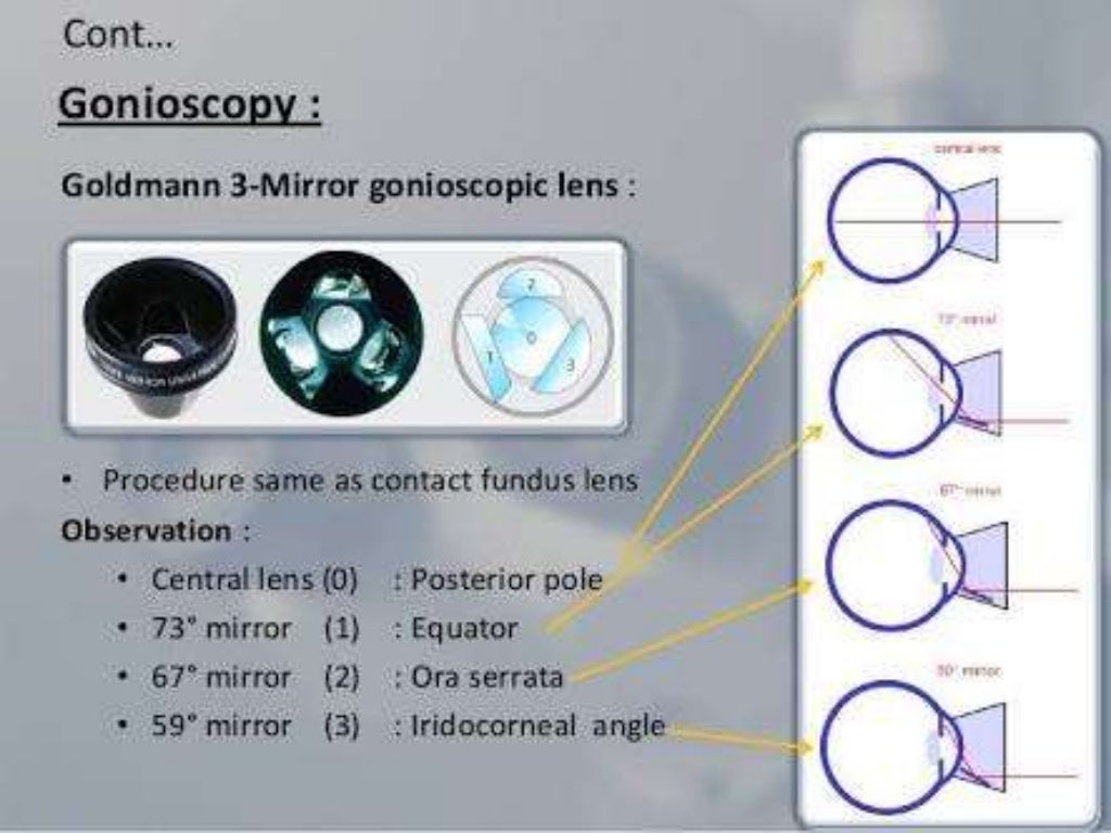 Gonioscopy Gonioscopic Lenses Principle And Clinical Aspects