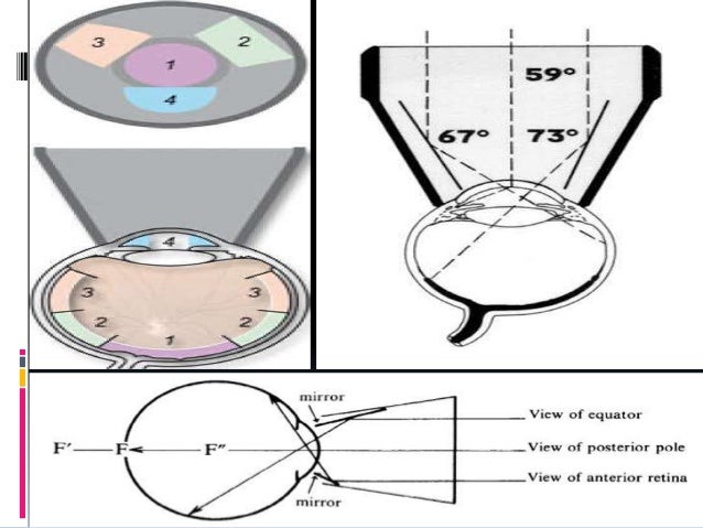 Gonioscopy: gonioscopic lenses, principle and clinical aspects