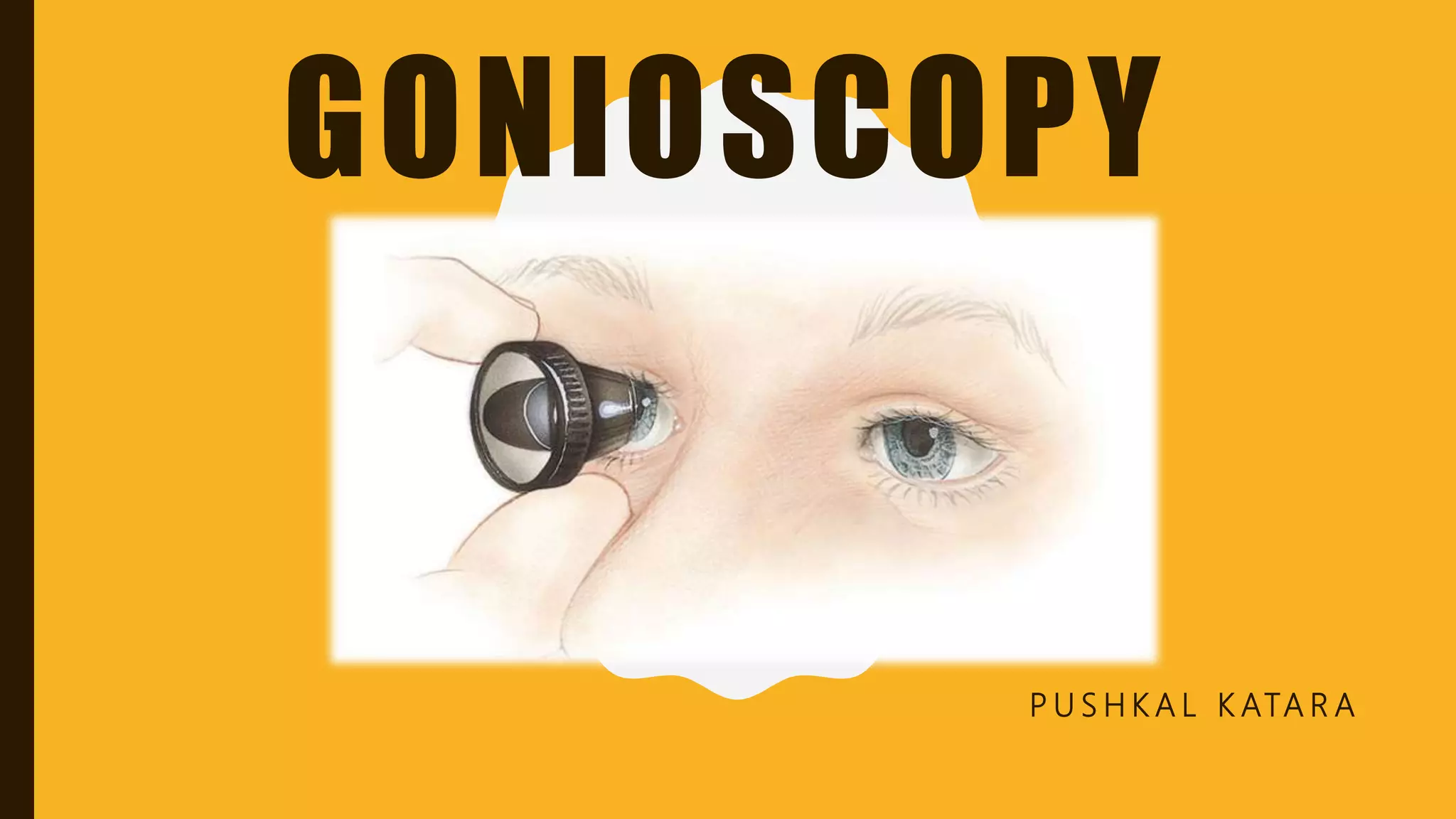 Gonioscopy | PPTX