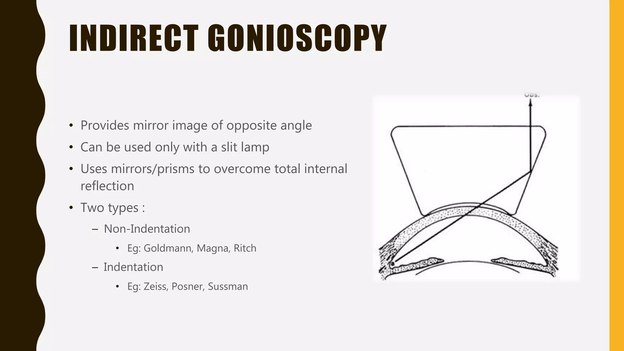 Gonioscopy | PPTX