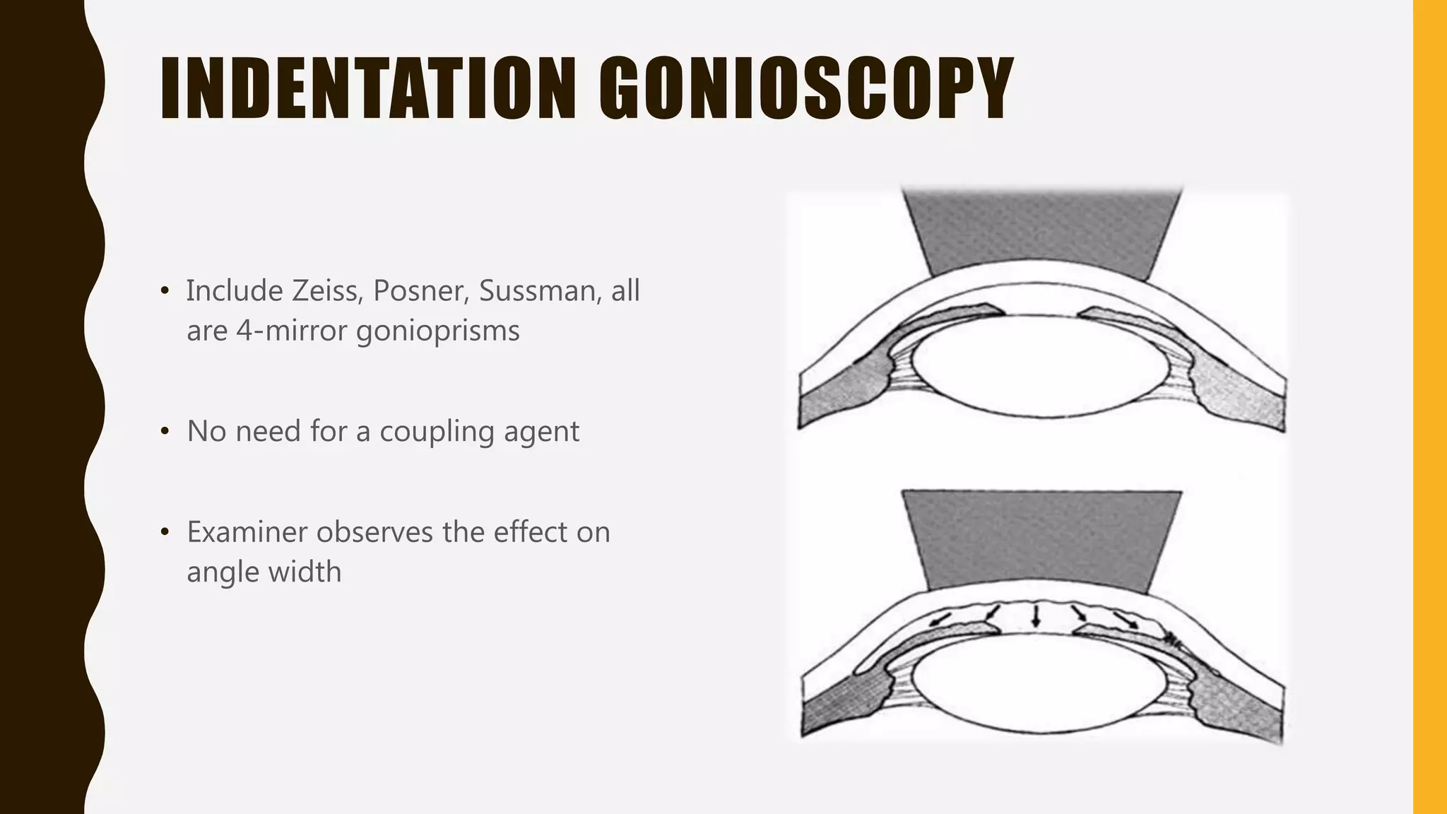 Gonioscopy | PPTX