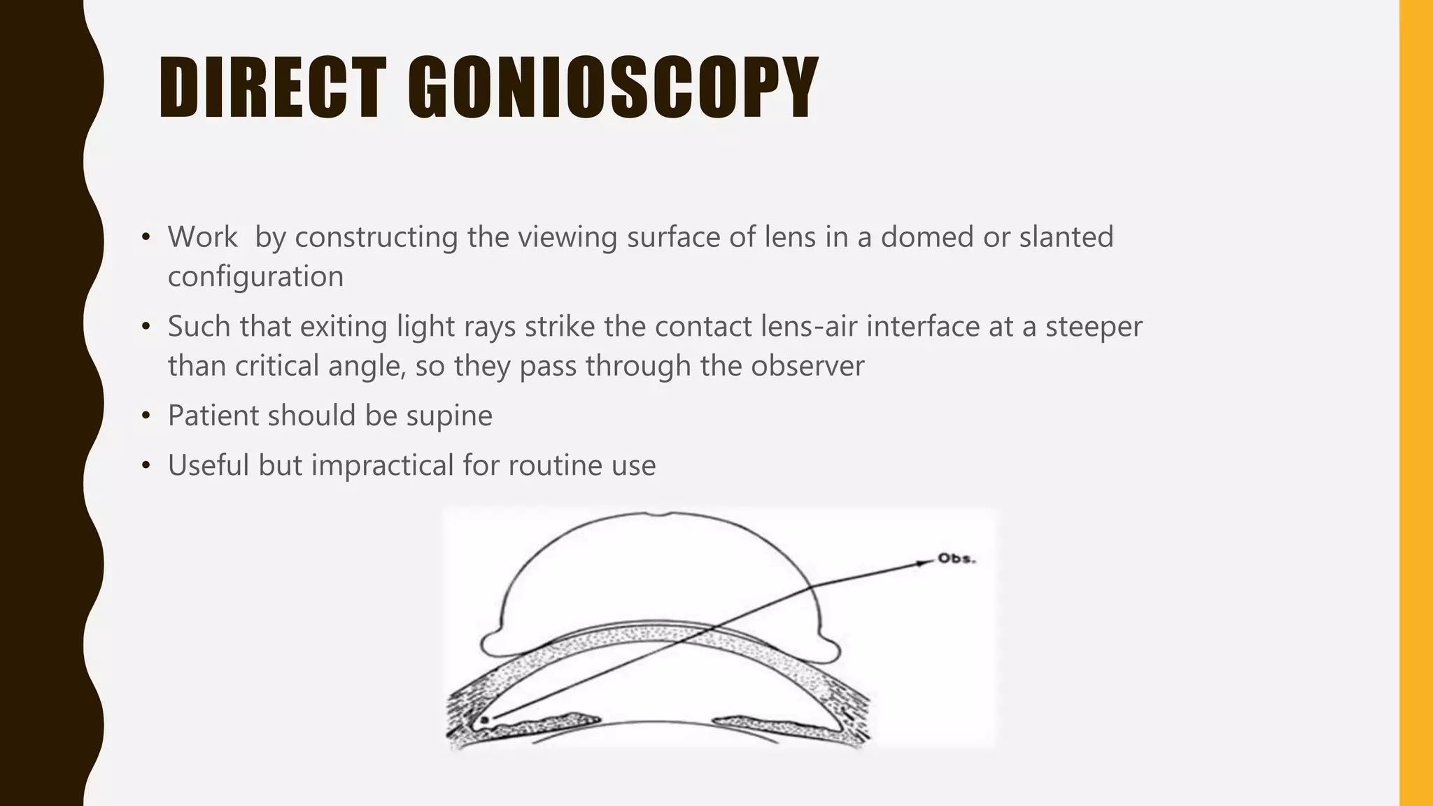 Gonioscopy | PPTX