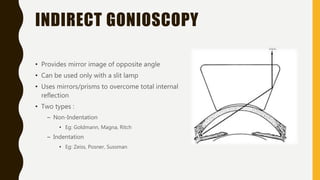 Gonioscopy | PPTX