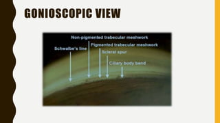 Gonioscopy | PPTX