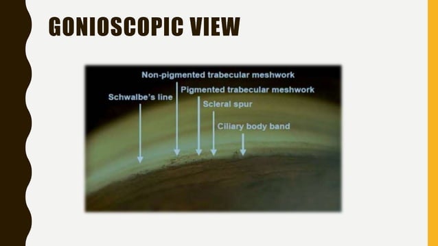 Gonioscopy | PPTX