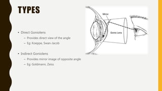 Gonioscopy | PPTX